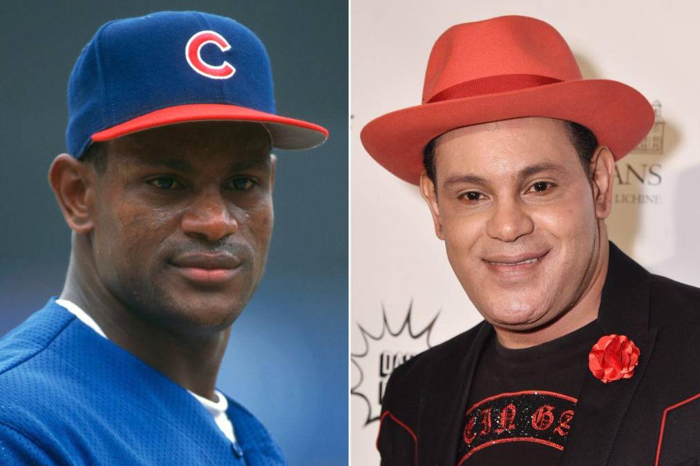 El sorpredente cambio del color de piel de Sammy Sosa