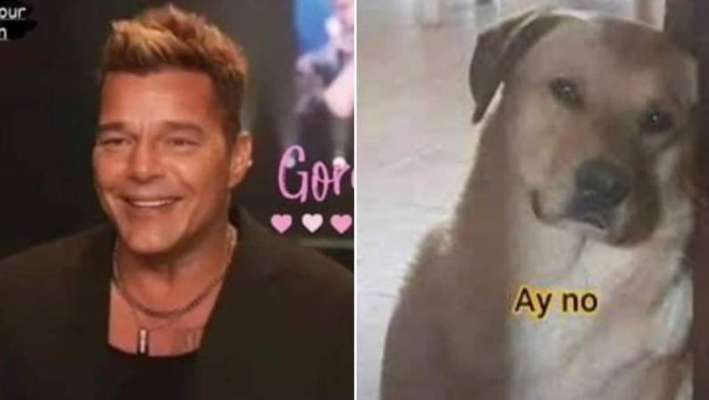 Ni bótox, ni cirugías: esto pasó con el rostro de Ricky Martin