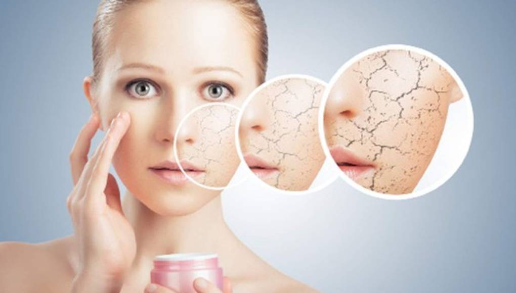 Cómo saber si tengo una piel seca o deshidratada