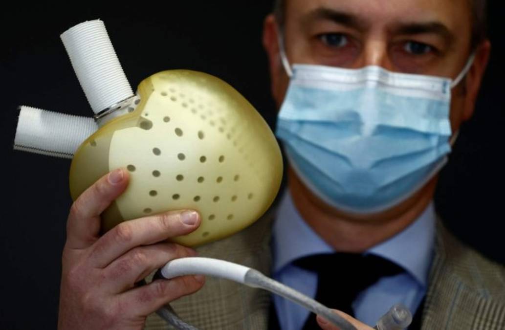 Fotos: así es el corazón artificial que comercializará una empresa ...