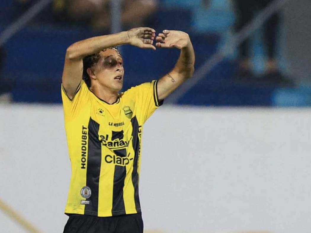Nixon Cruz es castigado y sanción al Olimpia