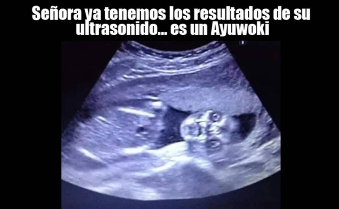 Los memes del Ayuwoki, el personaje viral del momento