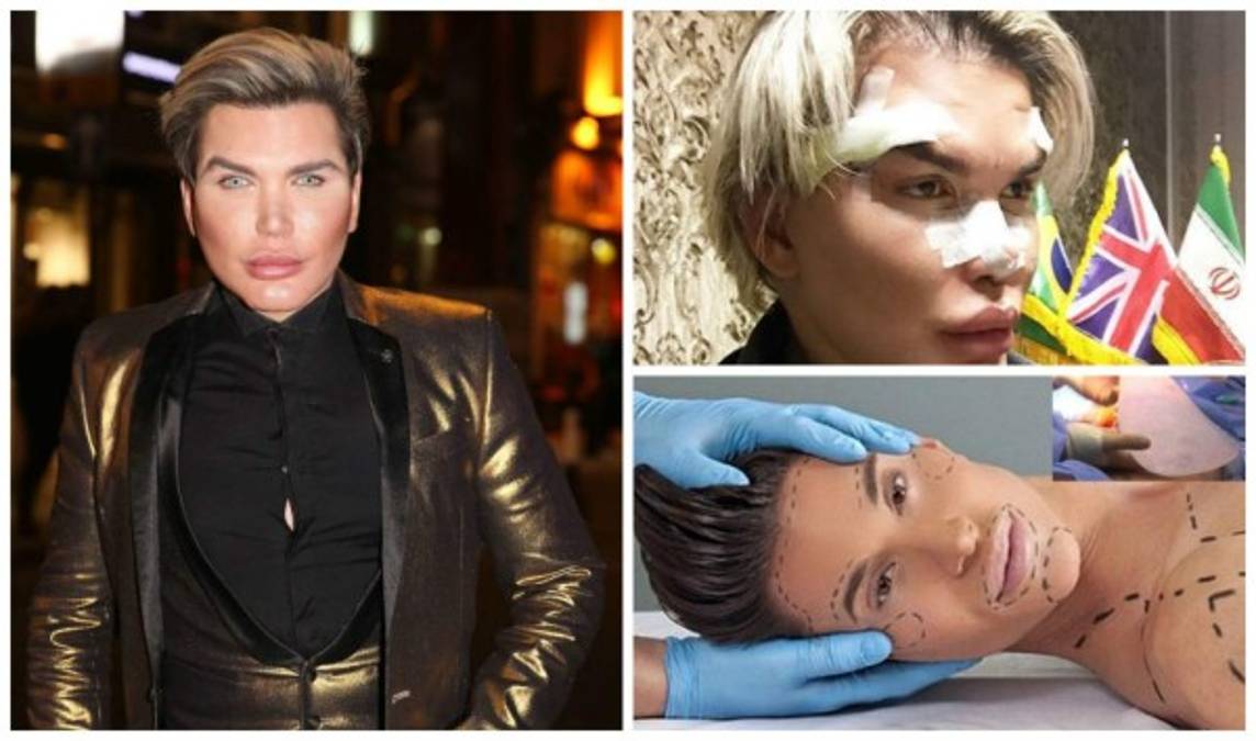 Así ha sido la transformación del 'Ken humano' y su obsesión por el bisturí