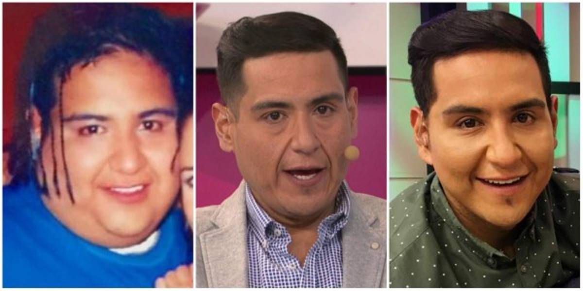 Irreconocible: así luce Rafita Balderrama tras operación de rostro