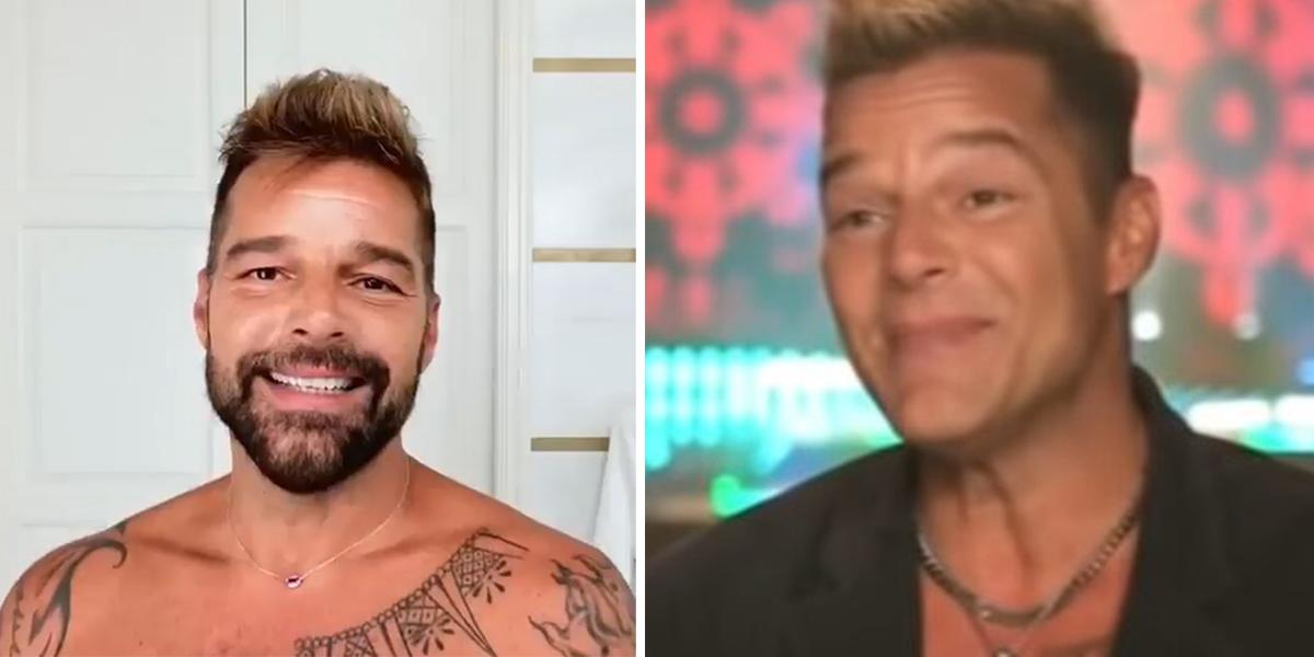 Ni bótox, ni cirugías: esto pasó con el rostro de Ricky Martin