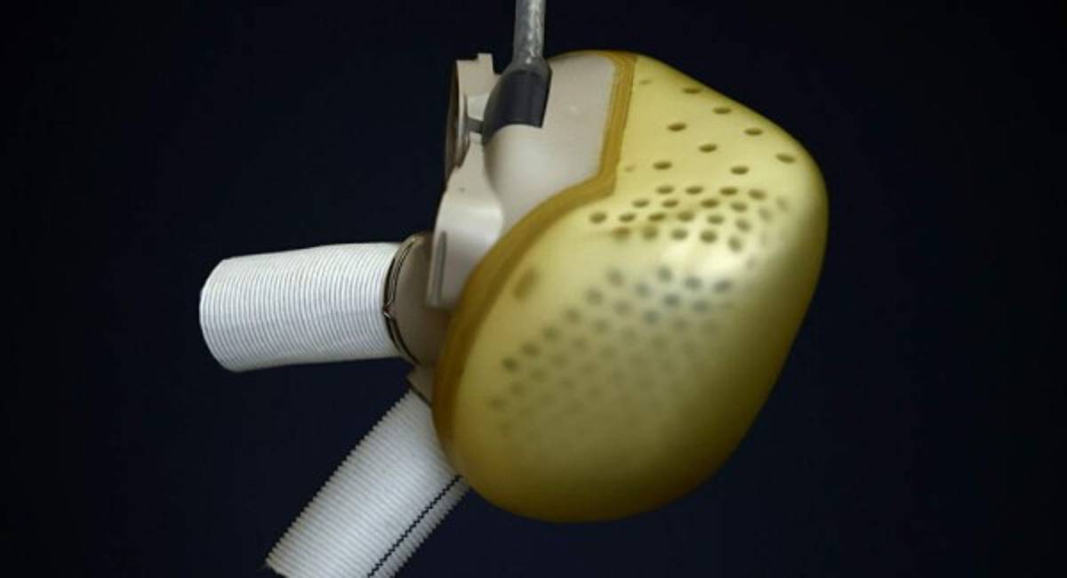 Fotos: así es el corazón artificial que comercializará una empresa ...