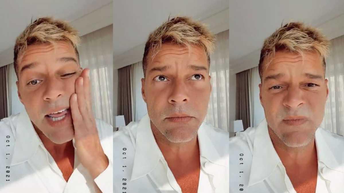 Ni bótox, ni cirugías: esto pasó con el rostro de Ricky Martin