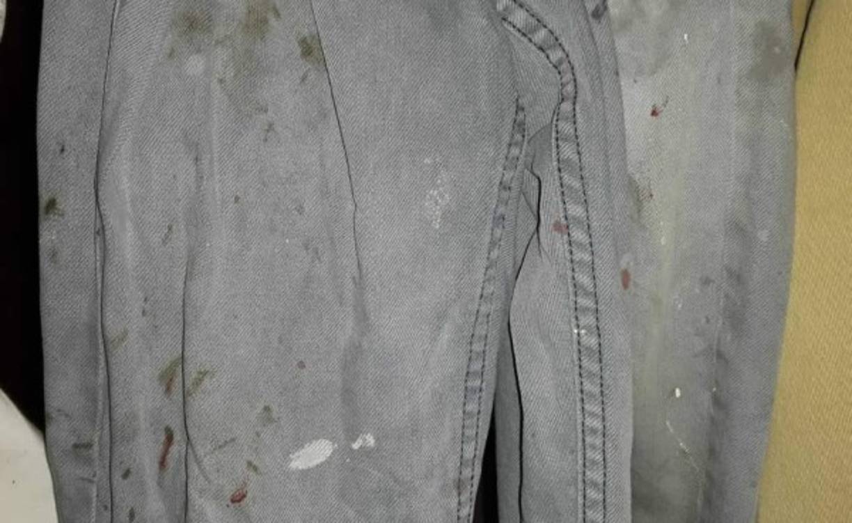 Manchas de sangre en ropa de hinchas del Motagua levanta sospechosas