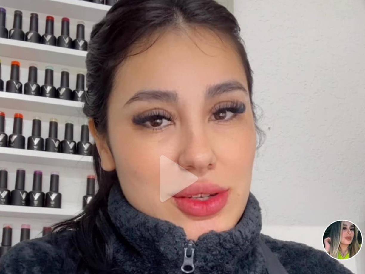 Muere famosa influencer Asli Fernández tras cirugía estética