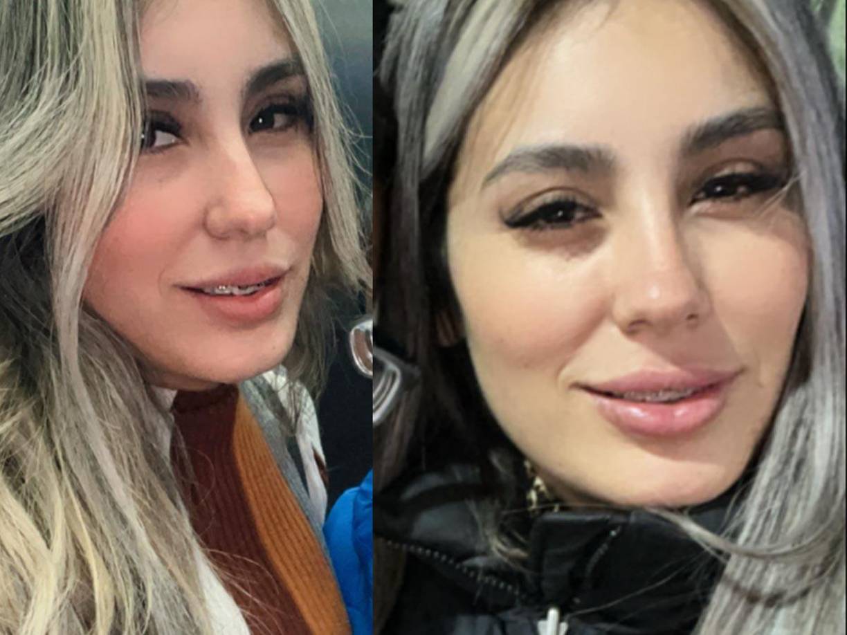 Muere famosa influencer Asli Fernández tras cirugía estética