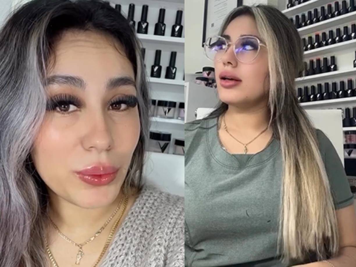 Muere famosa influencer Asli Fernández tras cirugía estética
