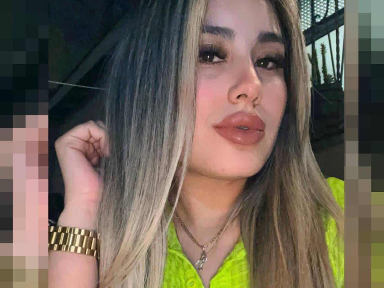 Muere famosa influencer Asli Fernández tras cirugía estética