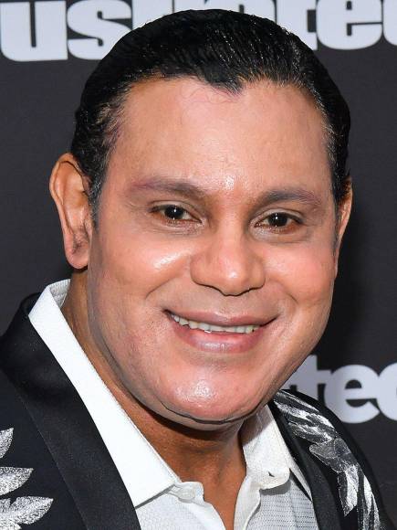 El sorpredente cambio del color de piel de Sammy Sosa