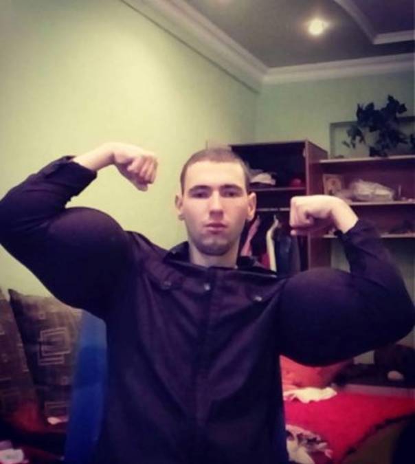 Se inyectó aceite y ahora es llamado el 'Popeye' ruso