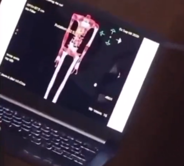 Revalan que ‘momias de Nazca’ no son extraterreste