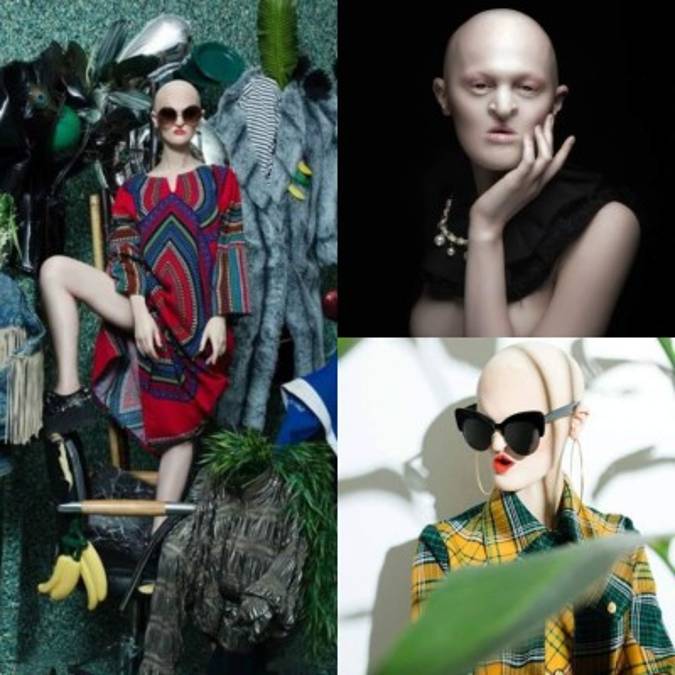 Modelos 'raras' que lograron triunfar con su belleza única