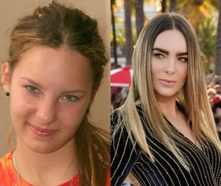 Belinda Antes Y Despues Cirugias