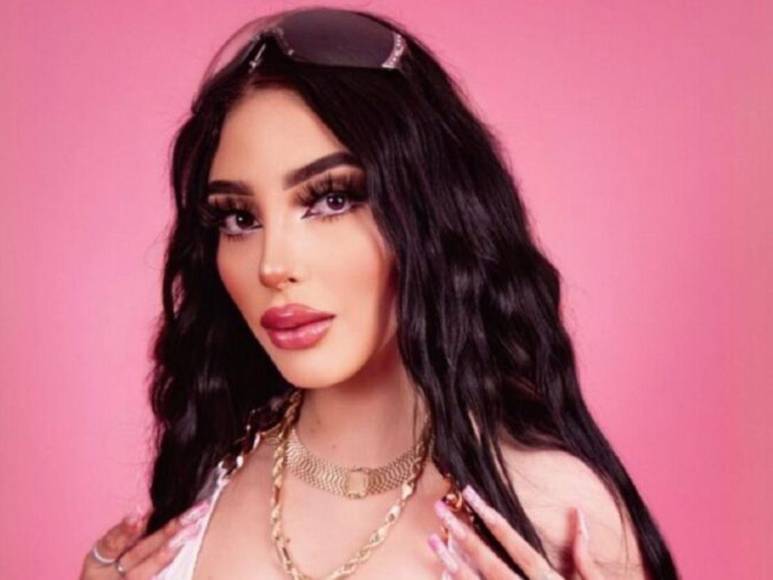 Bellakath a punto de perder la vida por una cirugía estética