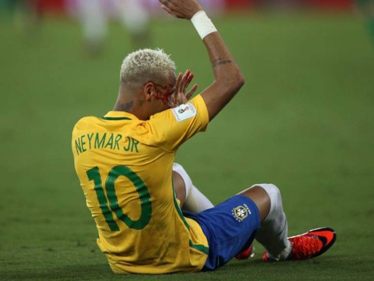 El brutal codazo que dejó a Neymar sangrando