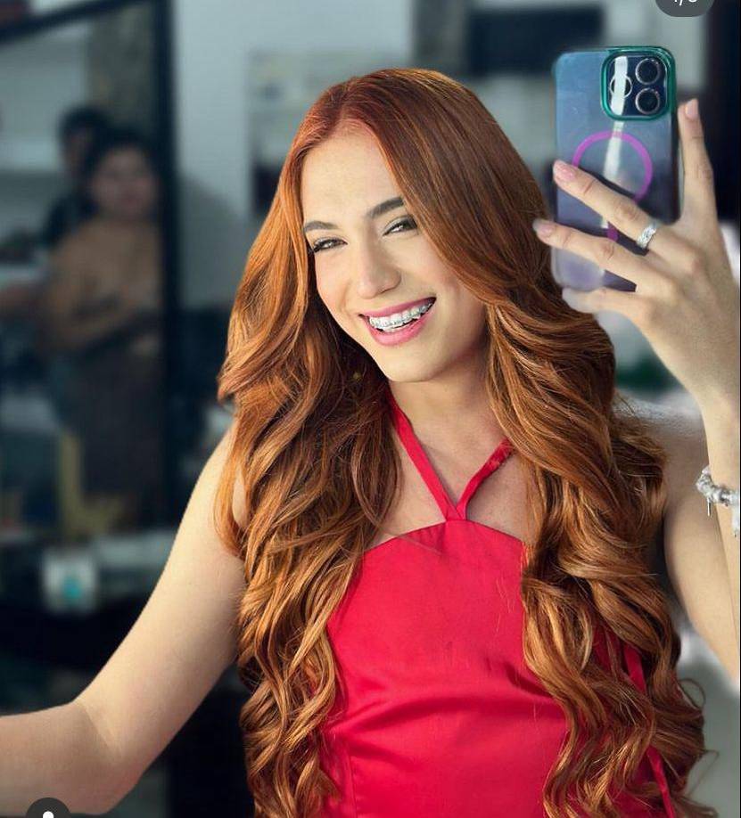 La Bicha Catracha se somete a cirugía para modificar su aspecto