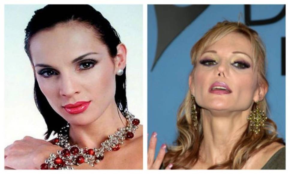 FOTOS: Famosos que se hicieron tan adictos a la cirugías y el botox que ...