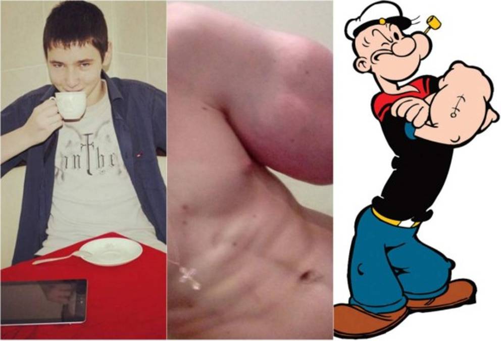Se inyectó aceite y ahora es llamado el 'Popeye' ruso